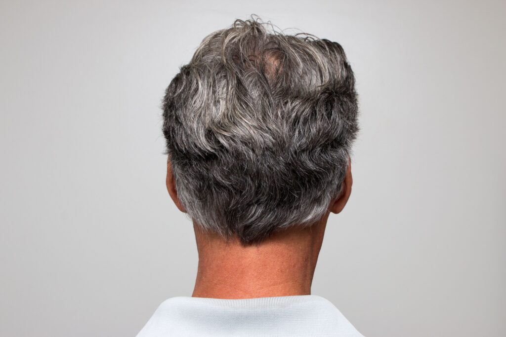 Five Reasons Your Hair Is Turning Gray and How to Slow It Down – SOFX